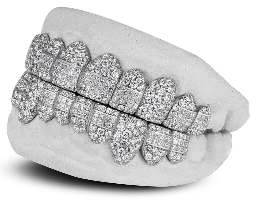 Diamond Grillz – Johnny Dang & Co