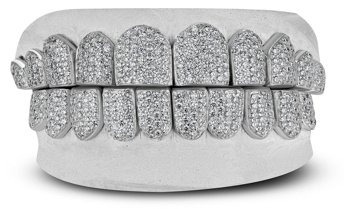 Diamond Grillz – Johnny Dang & Co