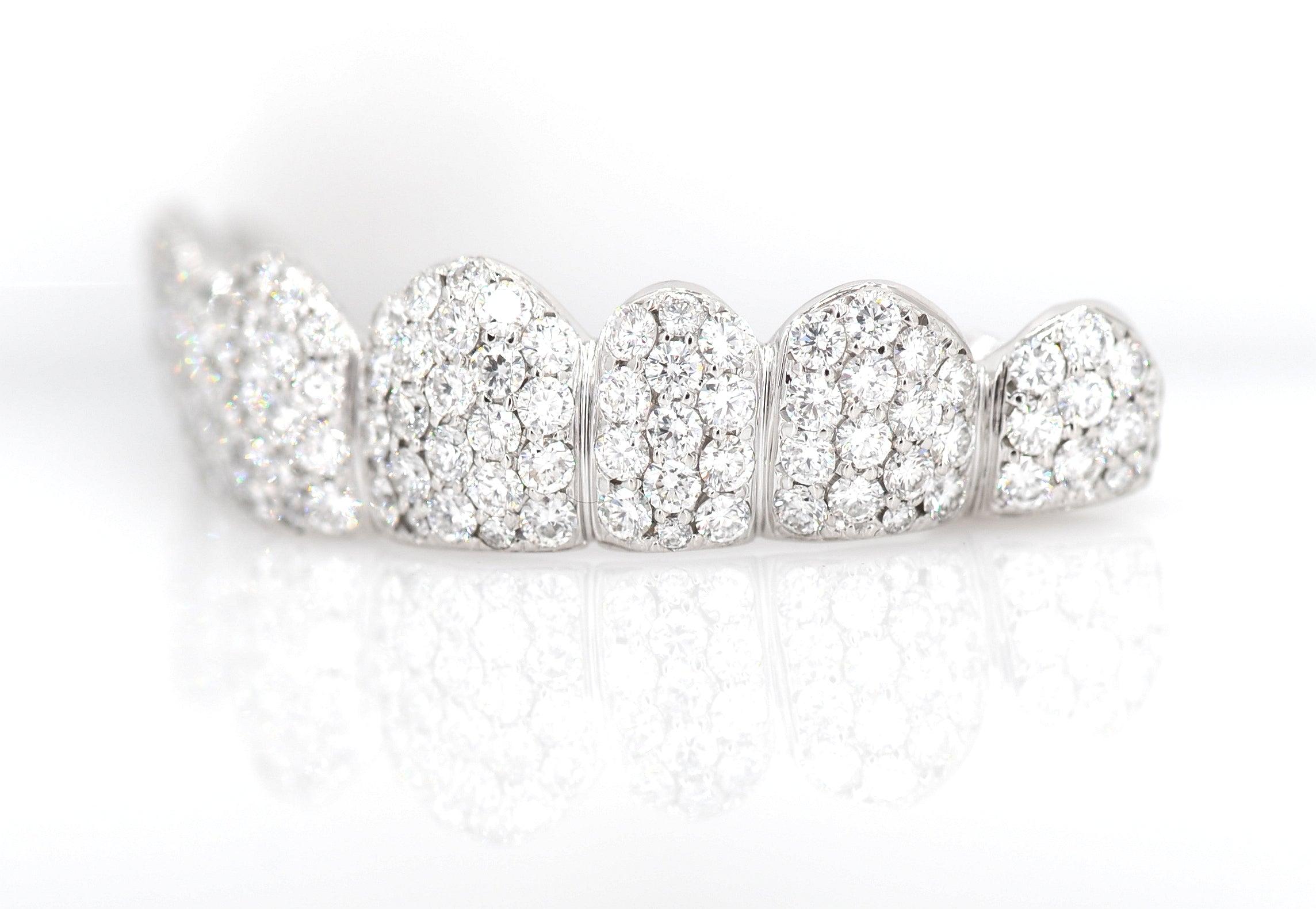 Diamond Grillz – Johnny Dang & Co