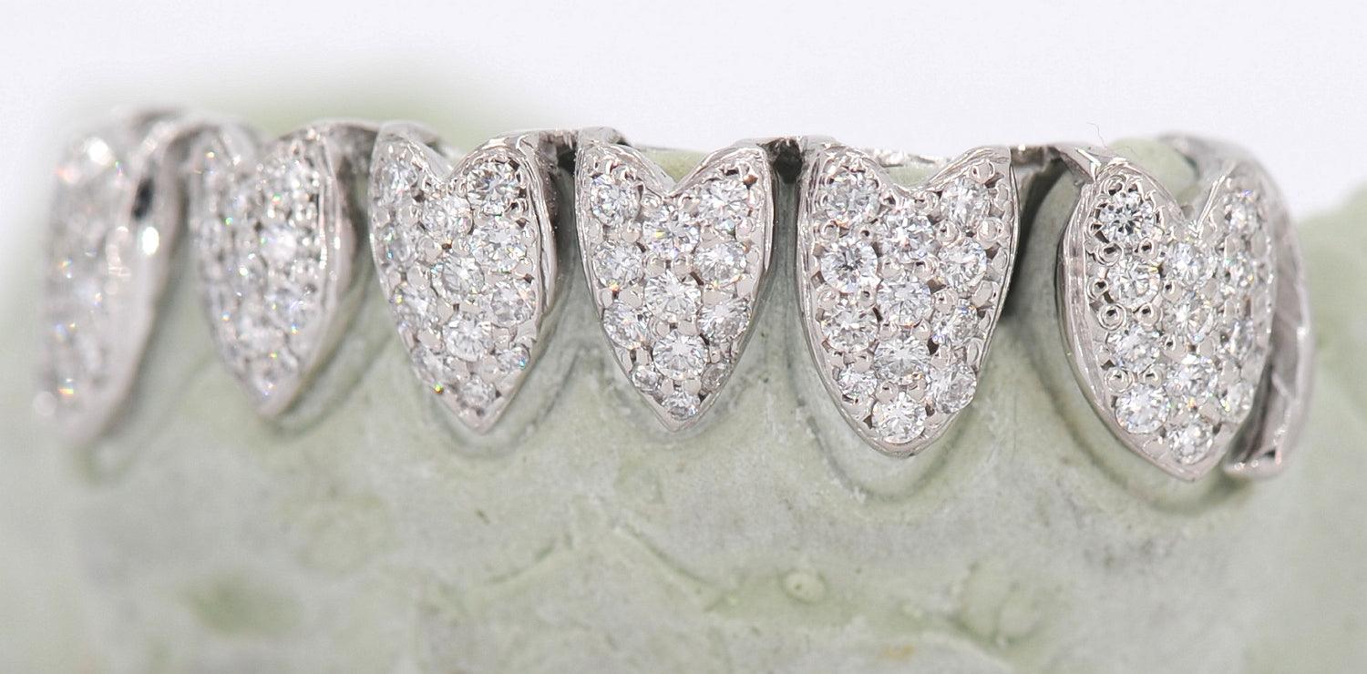 Diamond Grillz – Johnny Dang & Co