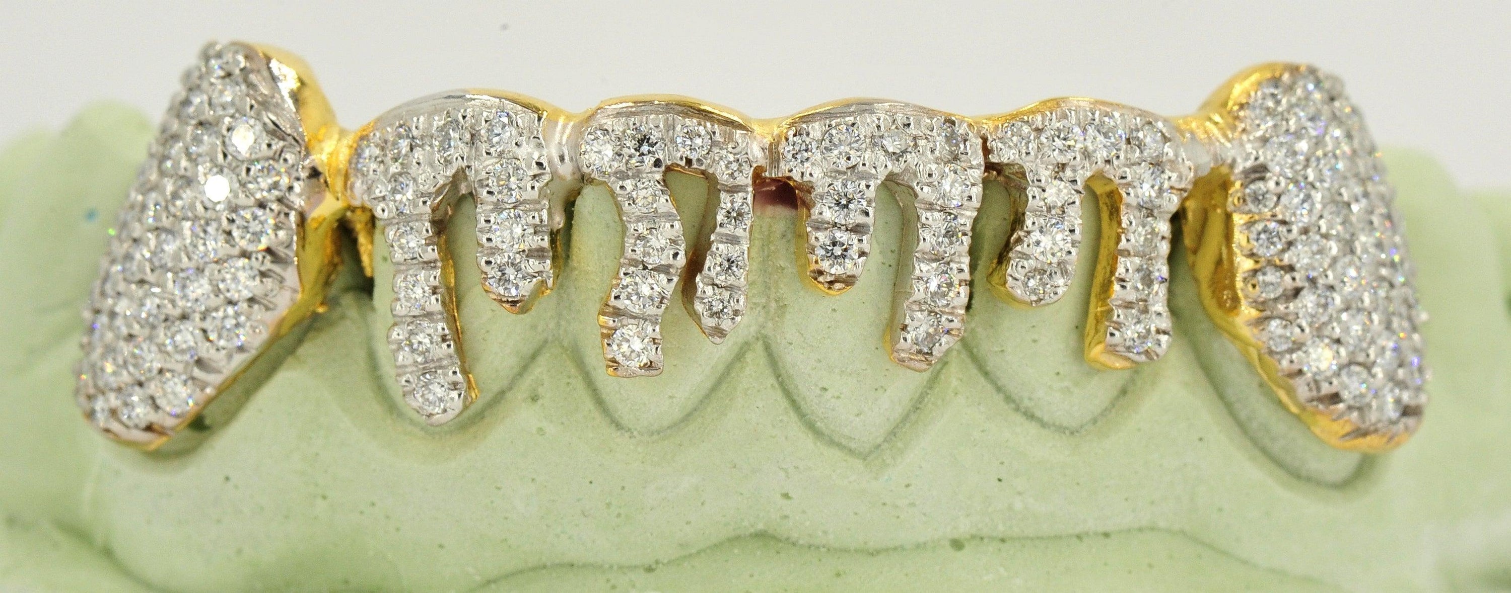 Diamond Grillz – Johnny Dang & Co