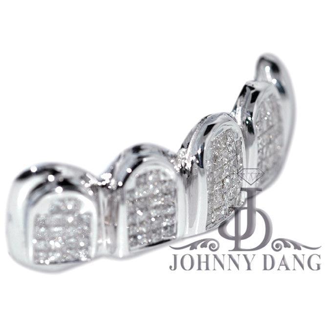 Invisible Set Grillz – Johnny Dang & Co