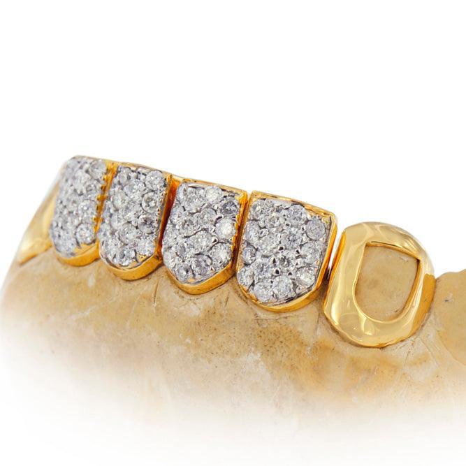 Gold and Diamond Permanentz – Johnny Dang & Co