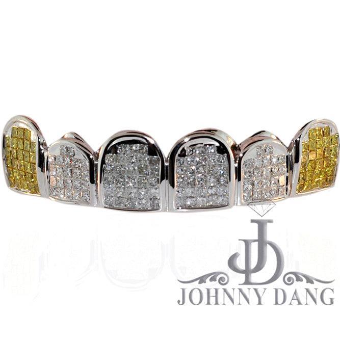 Invisible Set Grillz – Johnny Dang & Co
