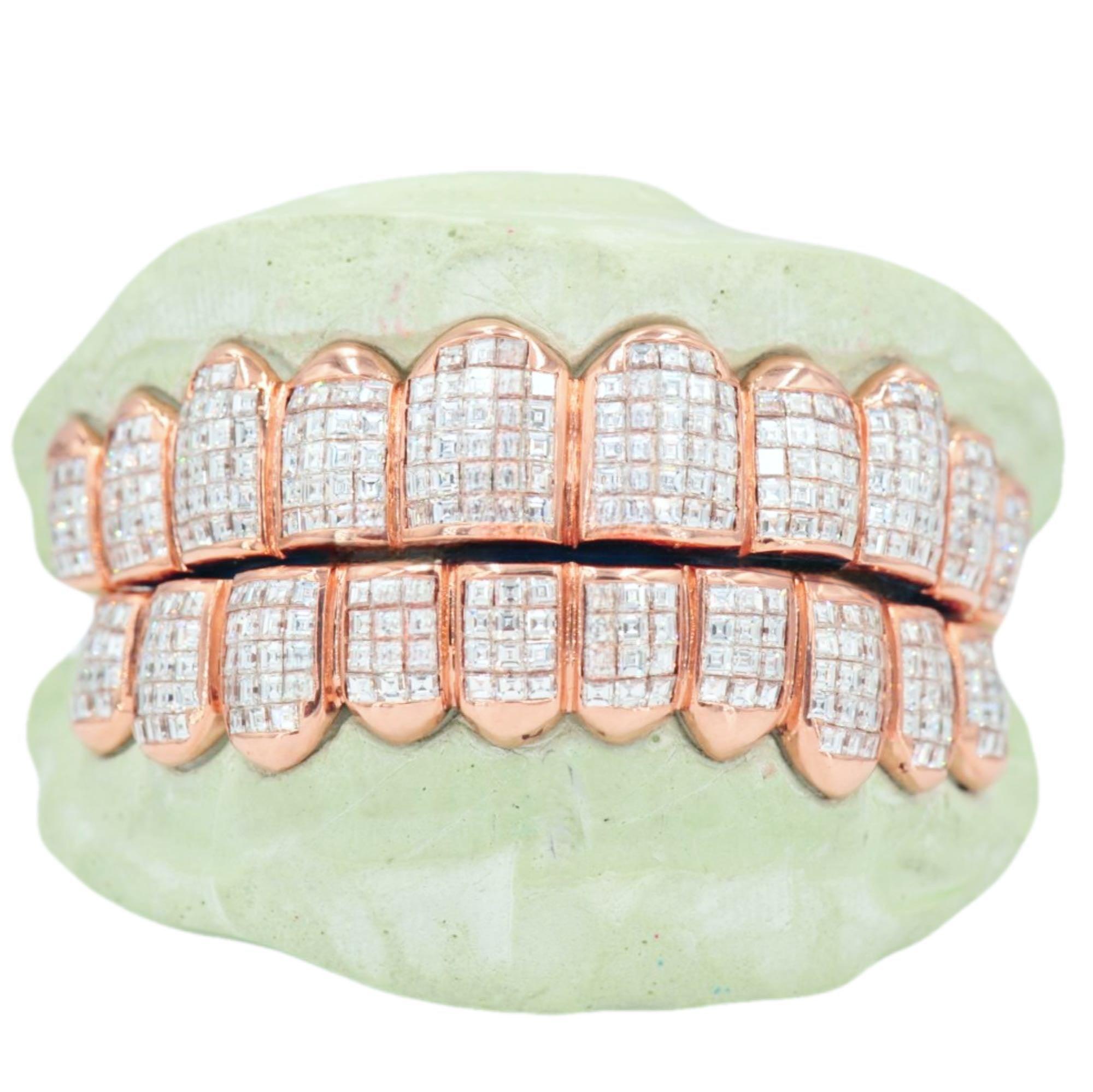 Grillz – Johnny Dang & Co